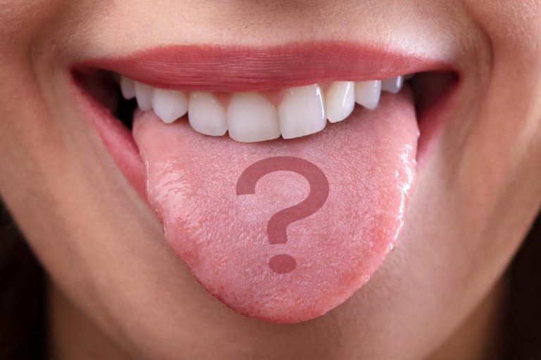 Vad säger din tunga om hälsan? – Body Cleanse